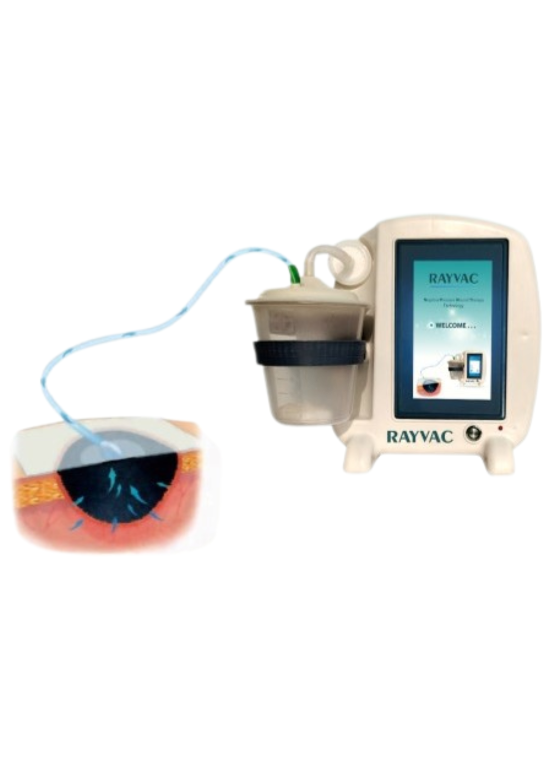 Rayvac